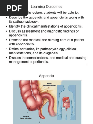 Ruptured Appendix Peritonitis