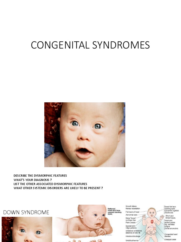 09 - Congenital Syndromes | PDF | Congenital Disorder | Clinical Medicine