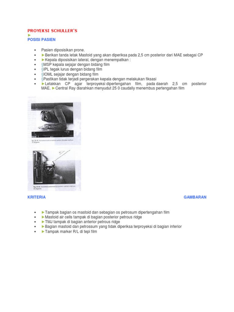 Schuller's Projection of the Temporal Bone | PDF