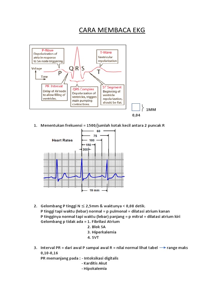 Cara Membaca Ekg Anak | PDF