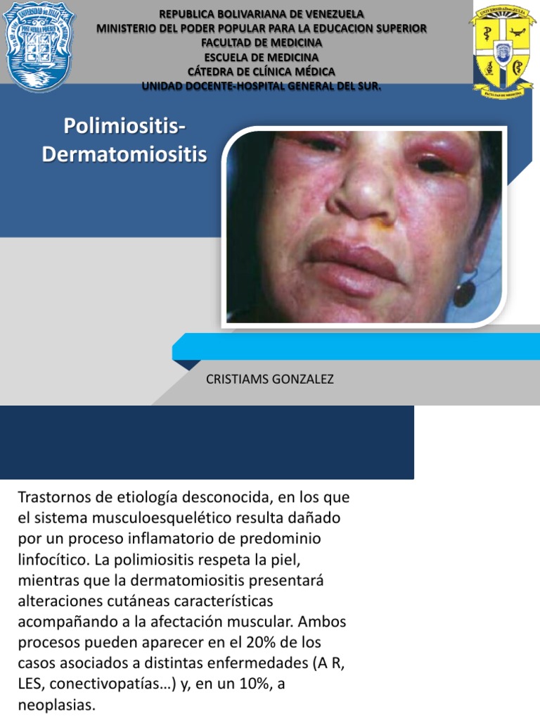 Polimiositis Dermatomiositis | PDF | Especialidades Medicas ...