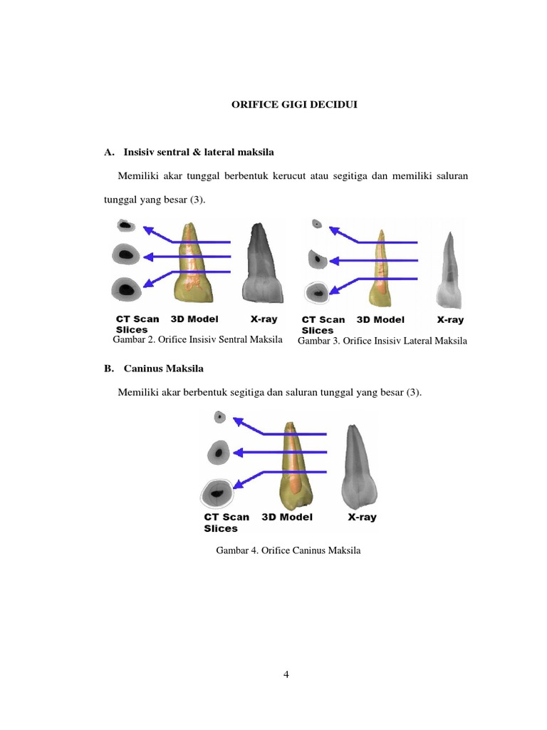 Gigi Decidui Orifice | PDF