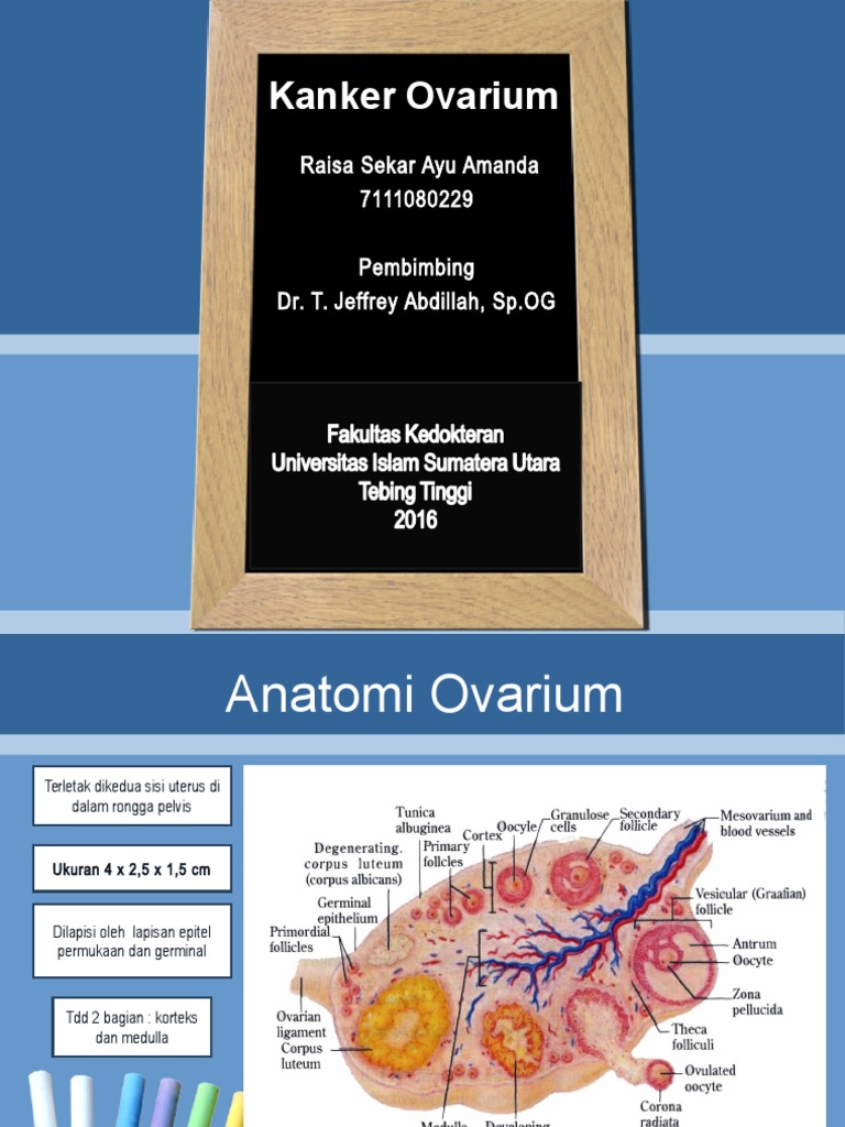Ca Ovarium PPT Fix | PDF