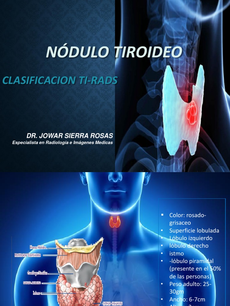 tirads.pdf | Ultrasonido médico | Glándulas