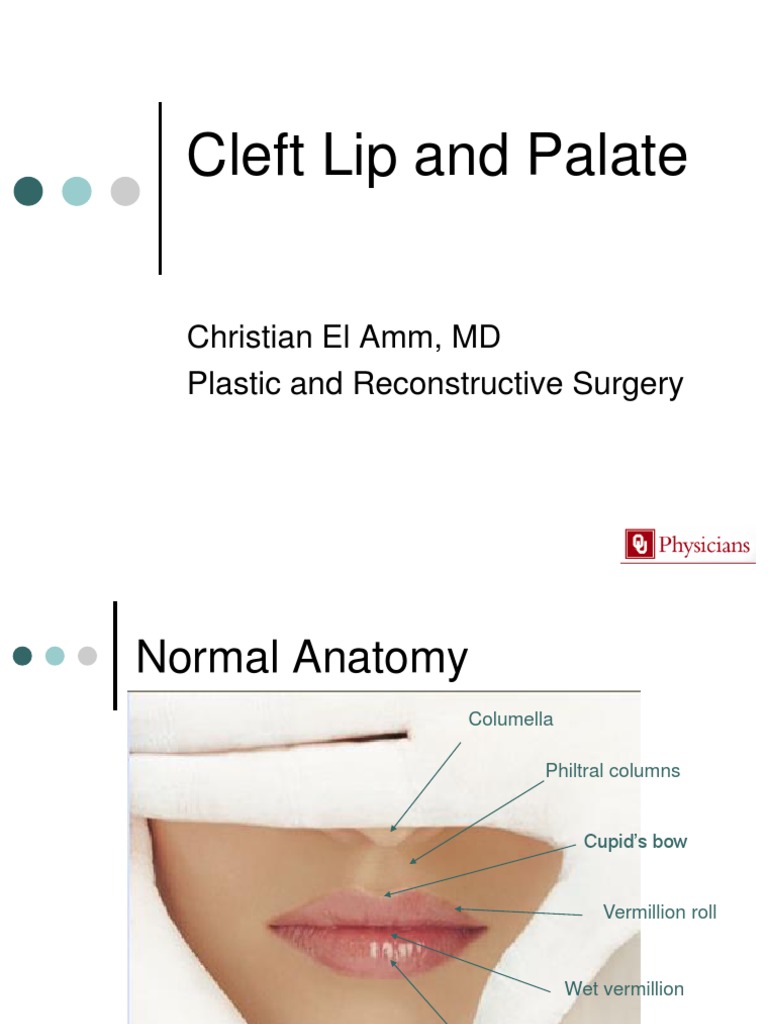 Cleft Lip and Palate | Human Anatomy | Face
