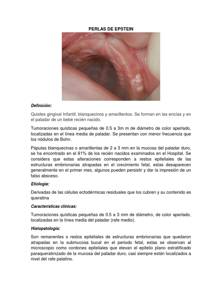 Perlas de Epstein en Recién Nacidos | PDF