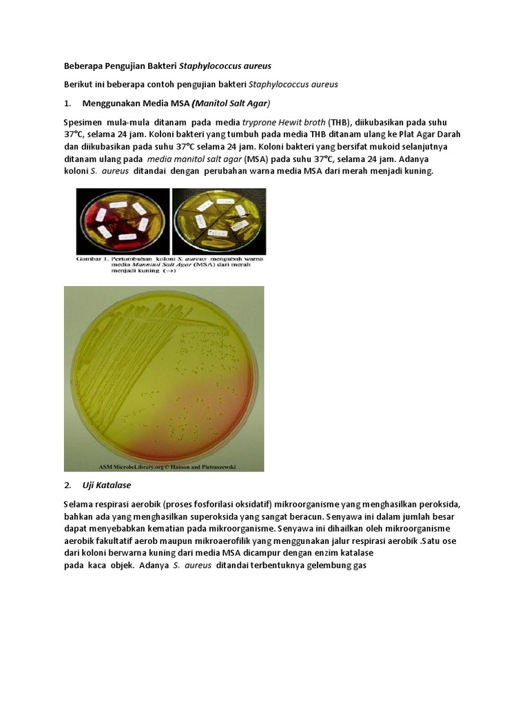 Beberapa Pengujian Bakteri | PDF