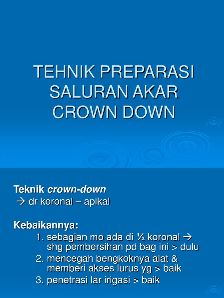 Crown Down Tehnik | PDF