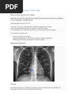 Chest X-Ray Template | PDF | Lung | Thorax