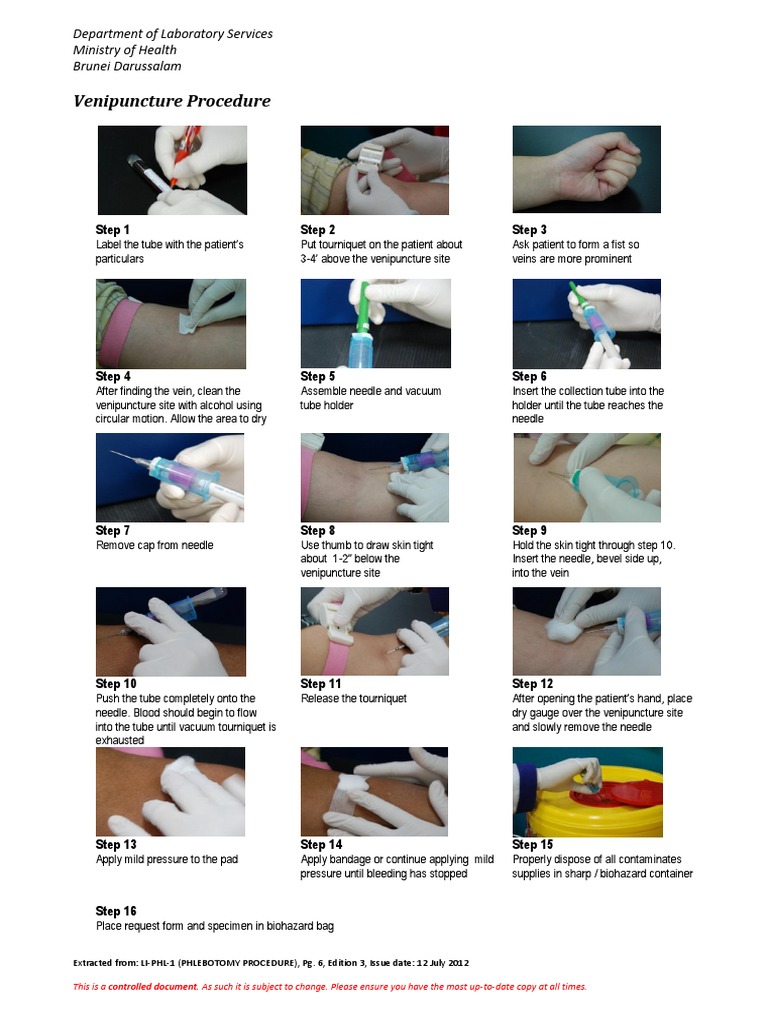 PH Le Botomy Procedure | PDF | Health Sciences | Clinical Medicine