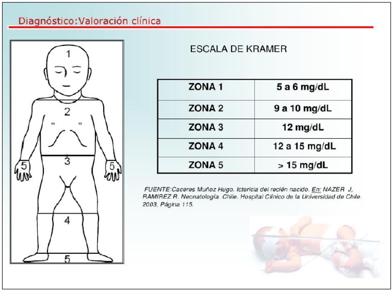 Test de Kramer | PDF
