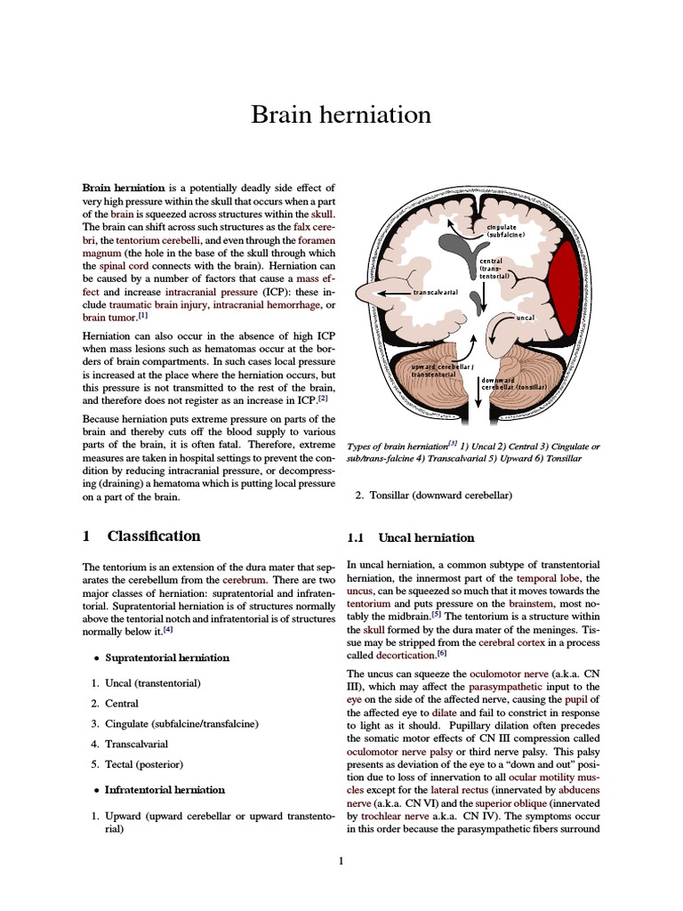 Brain-herniation.pdf | Central Nervous System | Human Anatomy