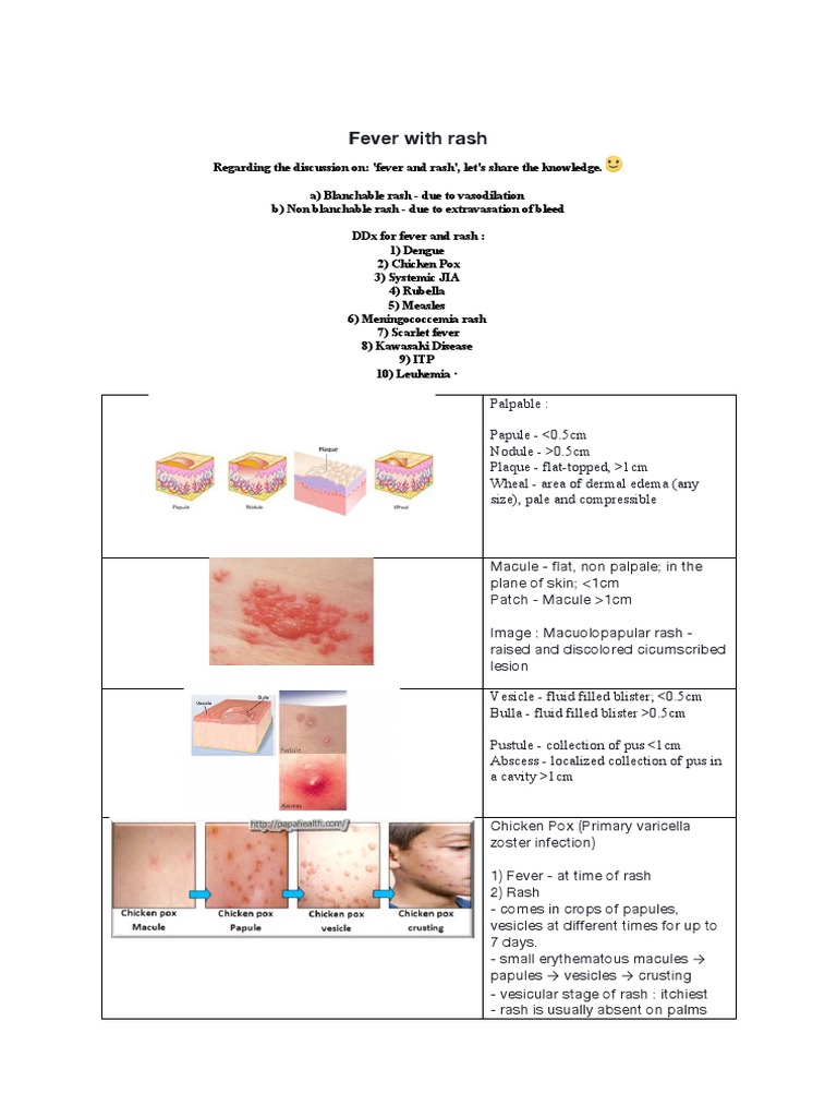 Fever with rash in table form. | Epidemiology | Microbiology