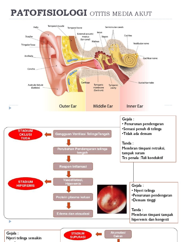 Patofisiologi Otitis Media Akut 2 | PDF