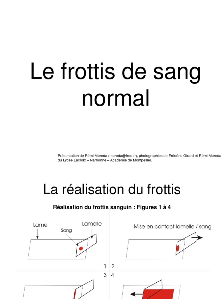Frottis Sanguin | PDF | Biologie cellulaire | Biologie
