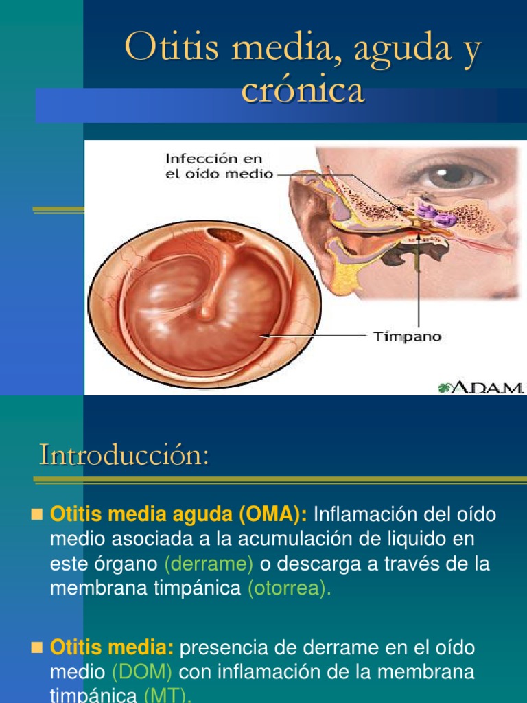 Otitis Media, Aguda y CR+ Nica | PDF | Epidemiología | Oído
