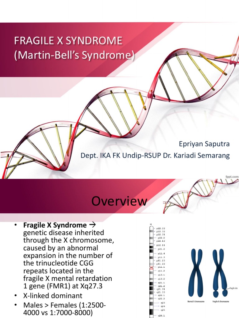 Fragile X | Epidemiology | Neurological Disorders