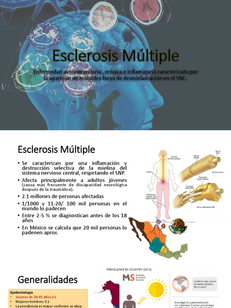 Esclerosis Multiple | PDF | Esclerosis múltiple | Mielina
