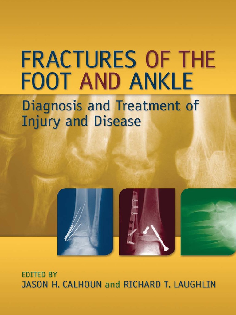 Fractures of The Foot and Ankle PDF | PDF | Ankle | Human Anatomy