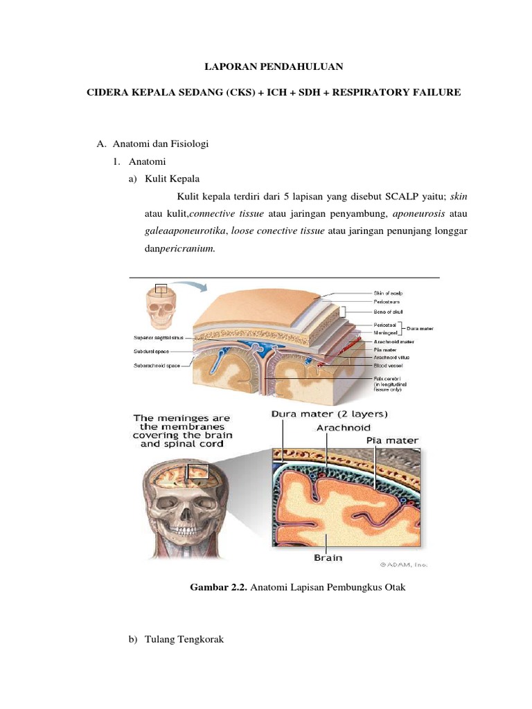 LAPORAN PENDAHULUAN COS+ICH+SDH+post trepanasi+RESPIRATORY FAILURE | PDF