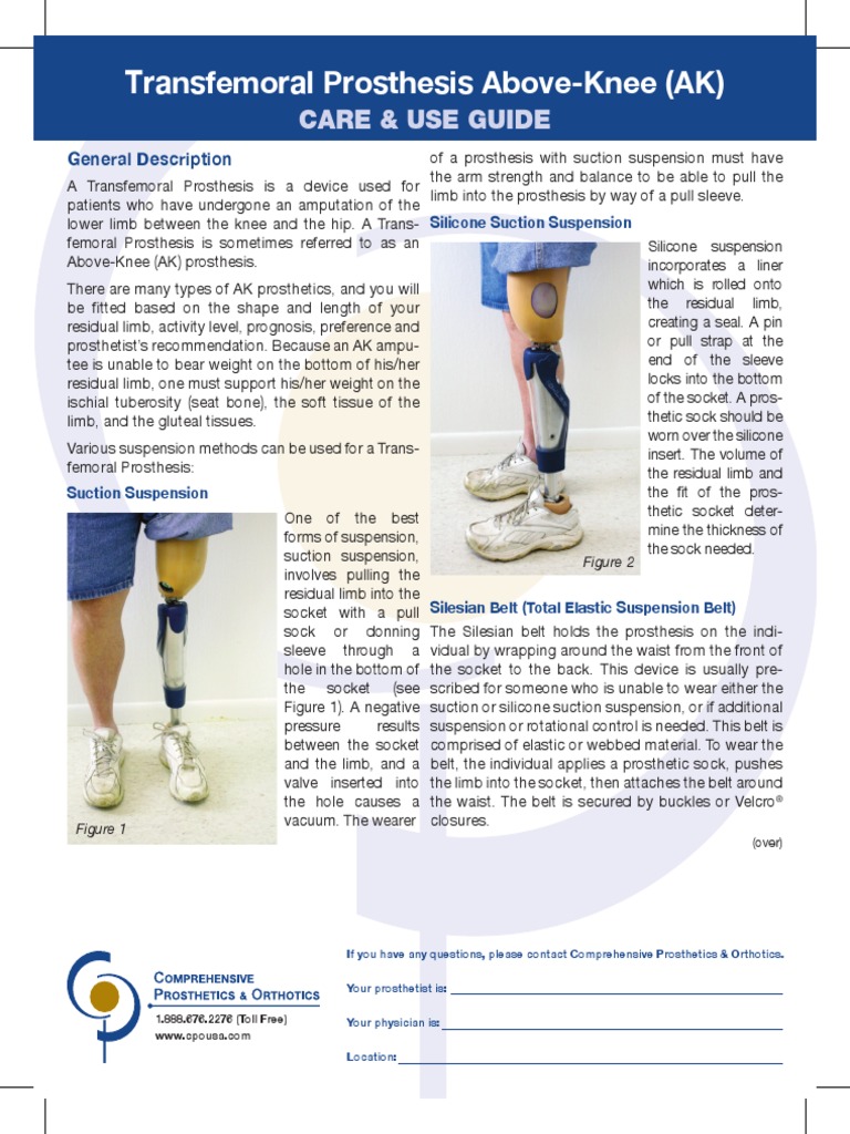 CPO Transfemoral Prosthesis Above Knee PDF | PDF | Prosthesis