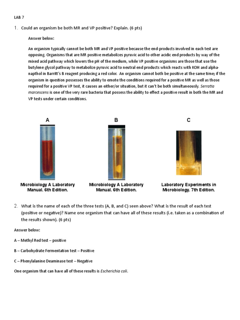 Microbiology LAB 7 | PDF | Bacteria | Microbiology