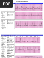 EKG Examples | PDF | Electrocardiography | Cardiovascular System