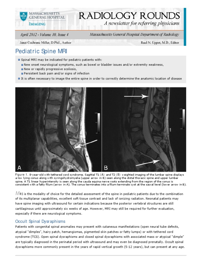 Pediatric Spine MRI: Occult Spinal Dysraphisms | PDF | Scoliosis ...
