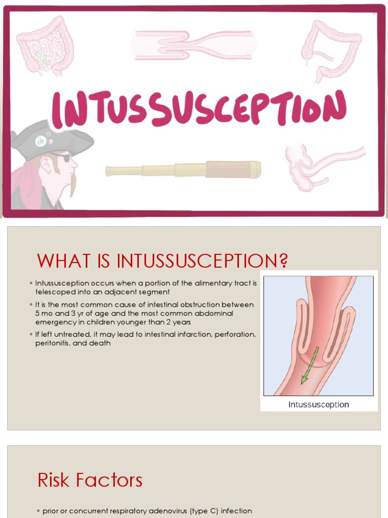 Intussusception Pedia Report | PDF | Digestive System | Gastroenterology