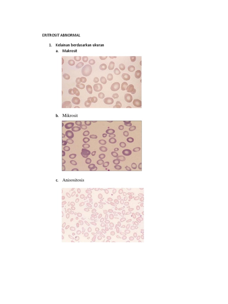 Eritrosit Abnormal | PDF