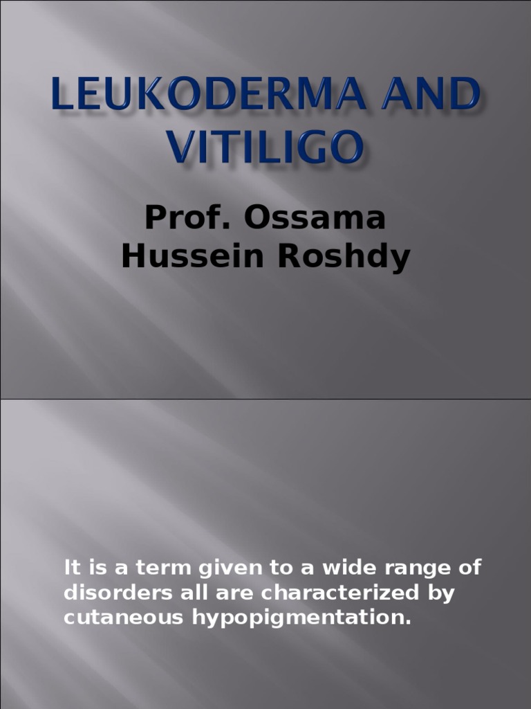 Leukoderma and Vitiligo | Medicine | Diseases And Disorders