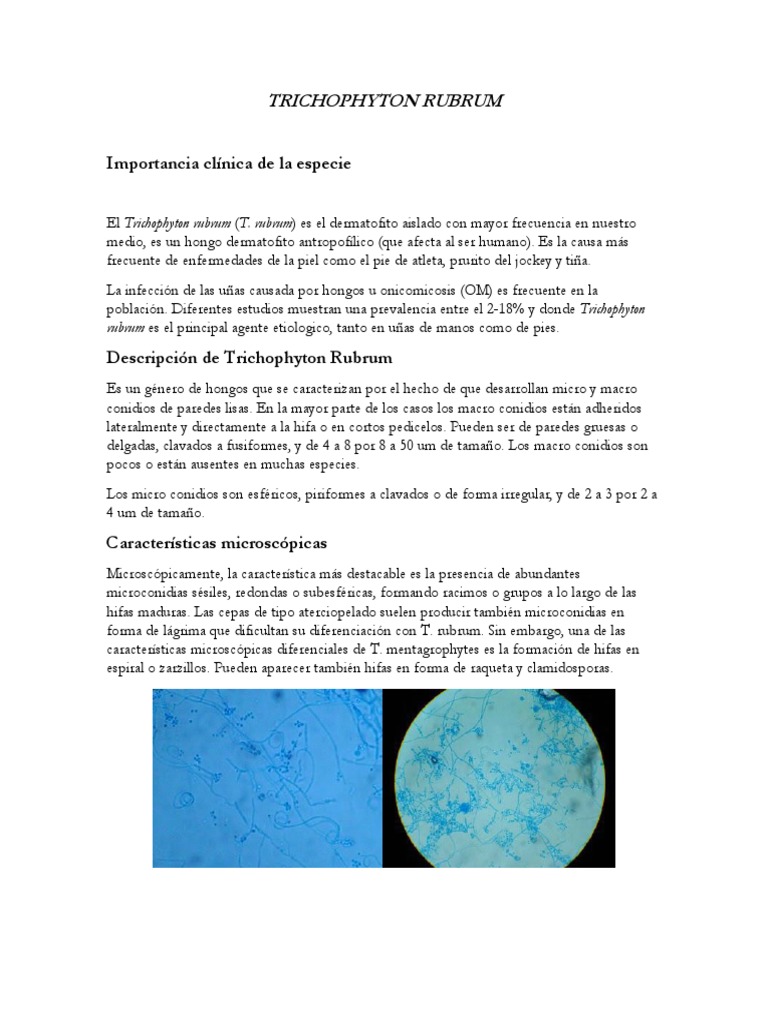 Trichophyton Rubrum | PDF | Epidemiología | Medicina Veterinaria