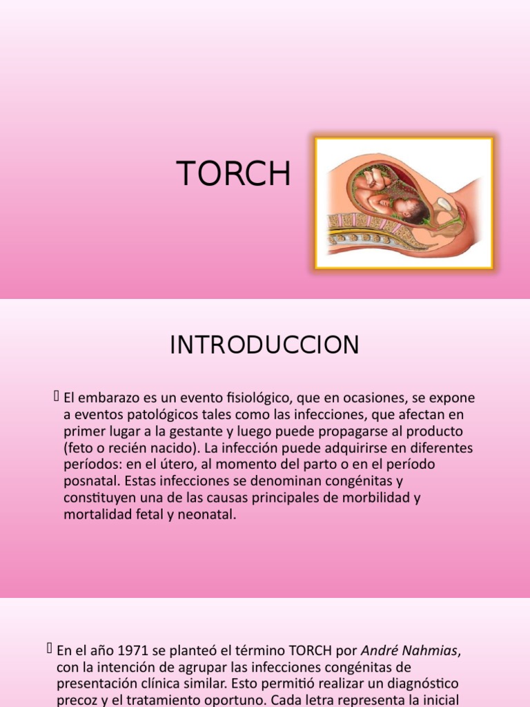 Torch | PDF