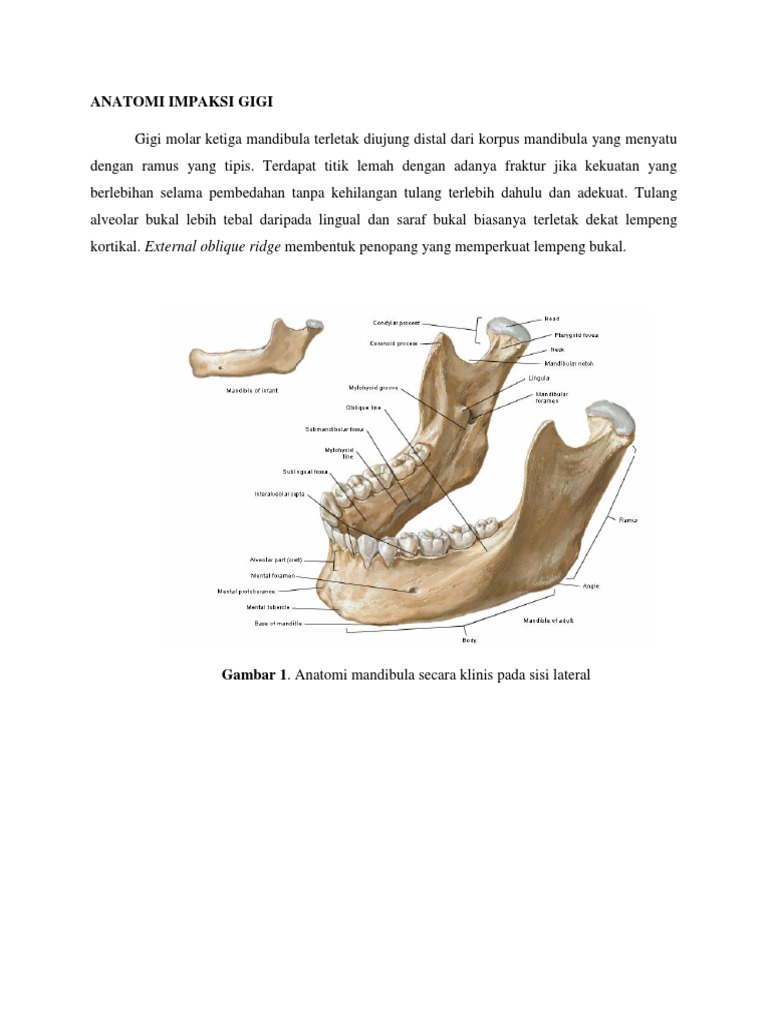 Anatomi Impaksi | PDF