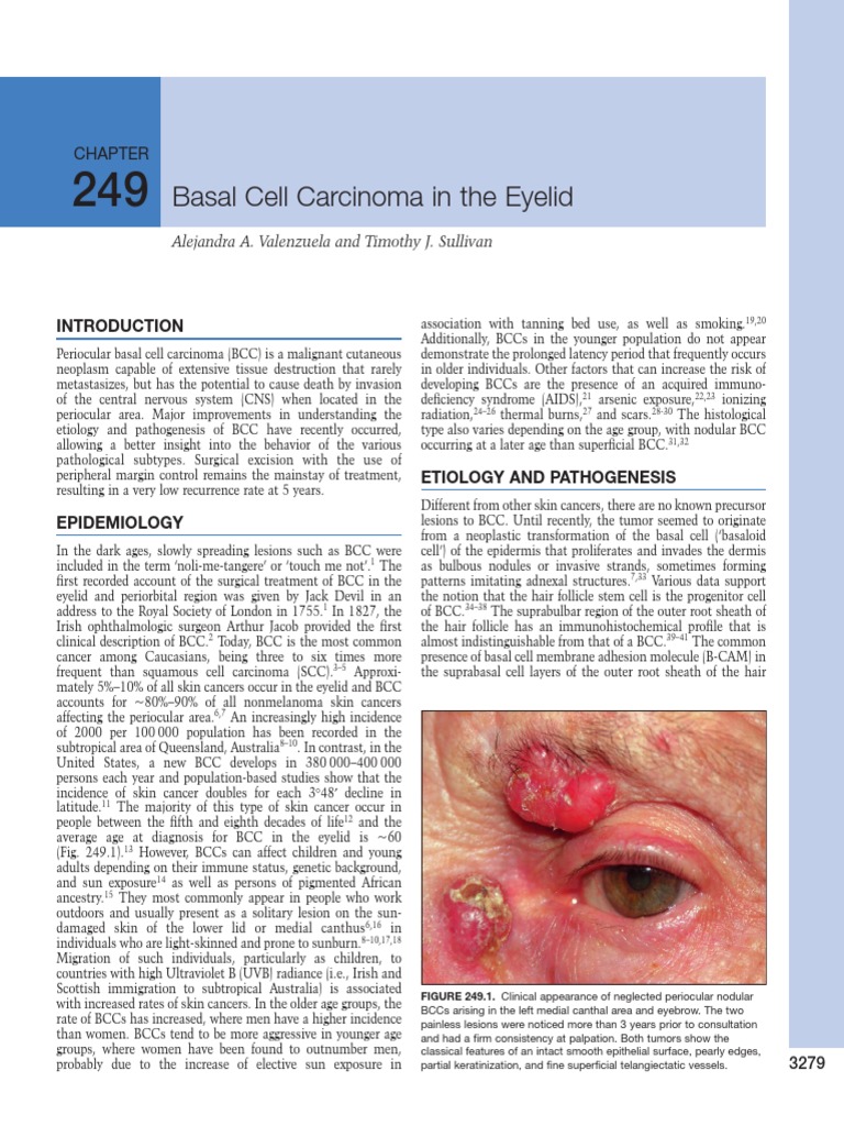 CA Basocelular | PDF | Skin Cancer | Metastasis