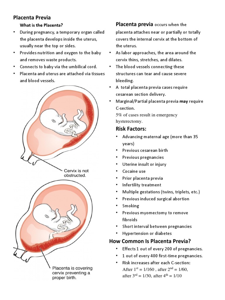 Placenta Previa Handout | Download Free PDF | Childbirth | Placenta