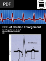 Ecg Interpretation J Point Stemi Criteria Equivalents and Others | PDF ...