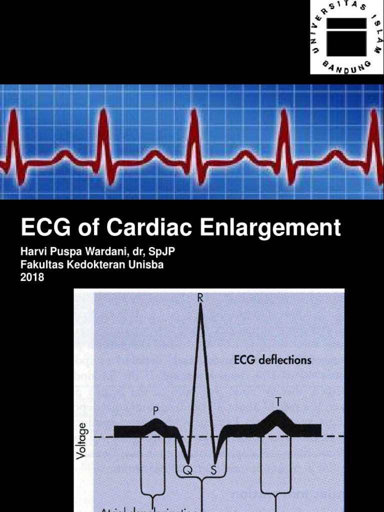 Ecg Abnormal 1-Hpw | PDF | Myocardial Infarction | Electrocardiography
