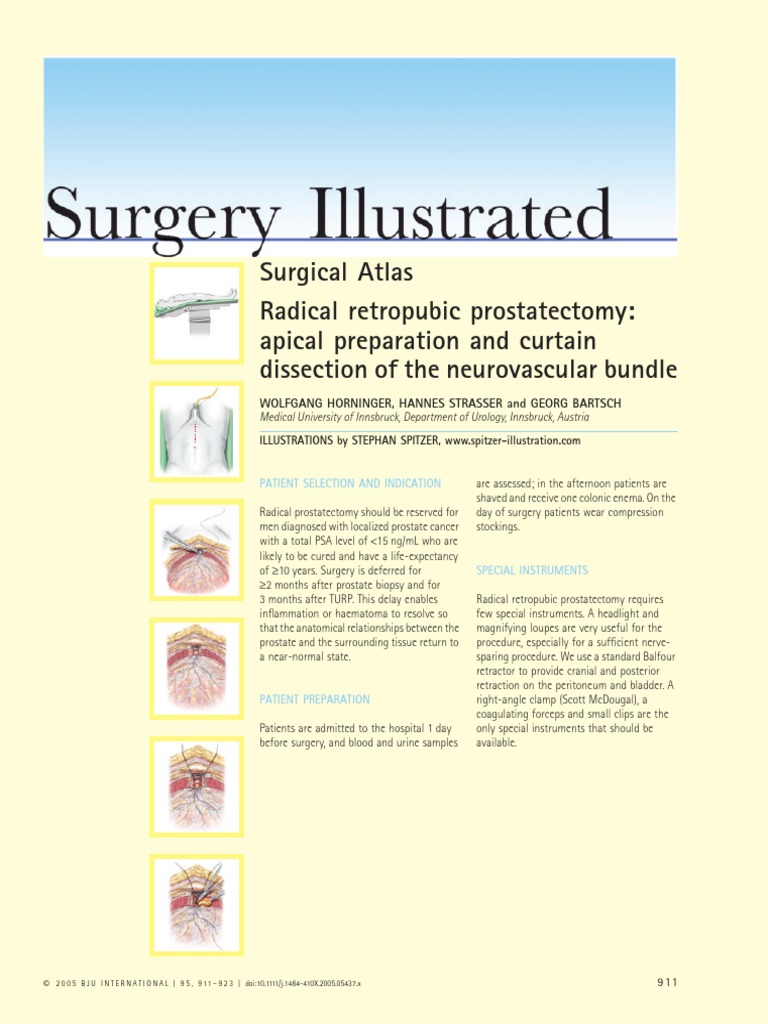 Surgical Atlas Radical Retropubic Prostatectomy: Apical Preparation and ...