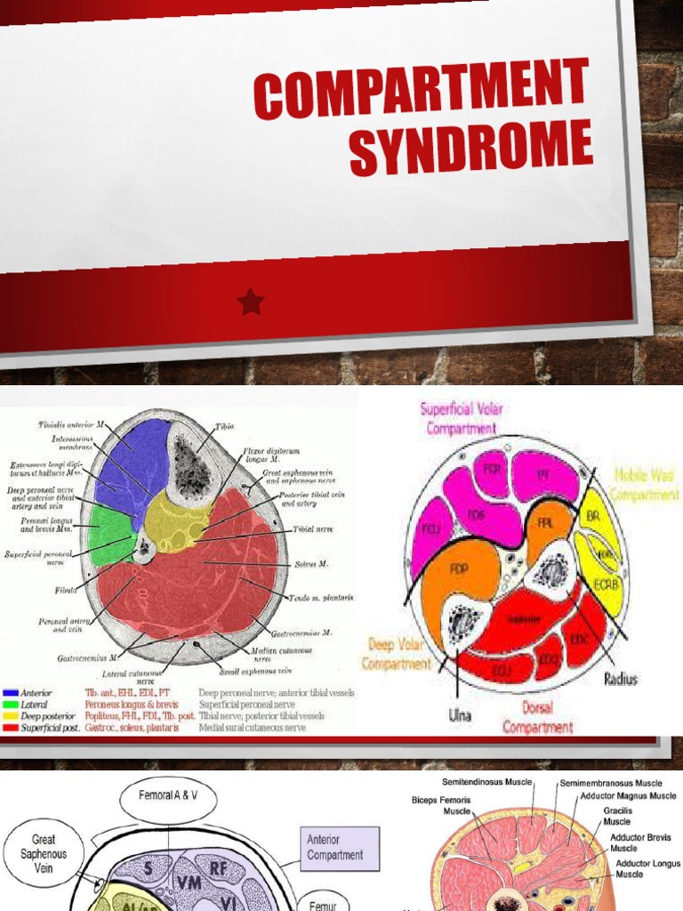 Compartment Syndrome | PDF | Clinical Medicine | Medical Specialties