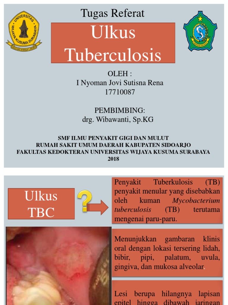 Ulkus TBC | PDF | Sains & Matematika