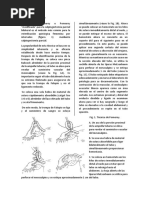 Técnica Quirúrgica de OTB: Salpingoclasia | PDF | Cirugía | Control de ...