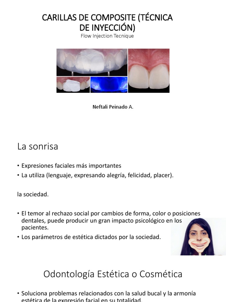Presentación Caso Clinico Carillas Inyectadas | PDF | Compuesto Dental ...