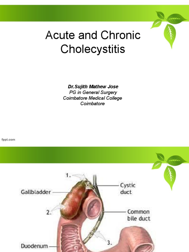 Acute Cholecystitis | PDF | Gallbladder | Organ (Anatomy)