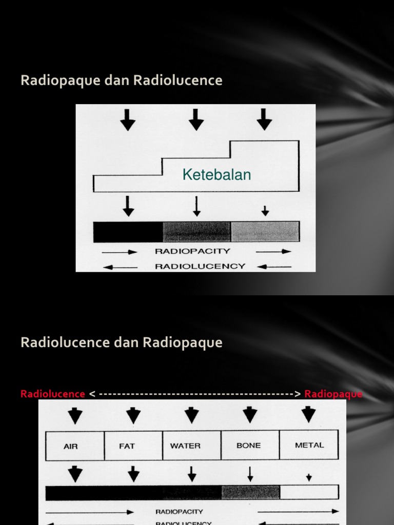 1 Radioopaque Radioluscent | PDF