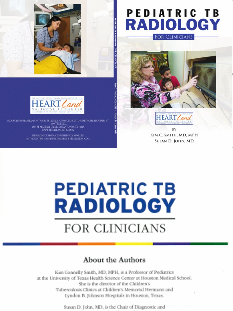 Pediatric TB Radiology PDF | PDF | Lung | Tuberculosis