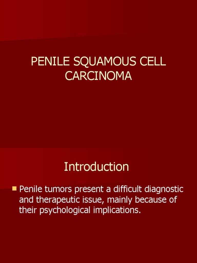 Glansectomy in Penile SCC Treatment | PDF | Neoplasms | Circumcision