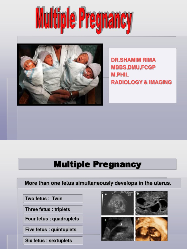 Overview of Multiple Pregnancy Types | PDF | Multiple Births | Twin