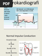 ECG Rhythm Interpretation | PDF | Electrocardiography | Cardiology