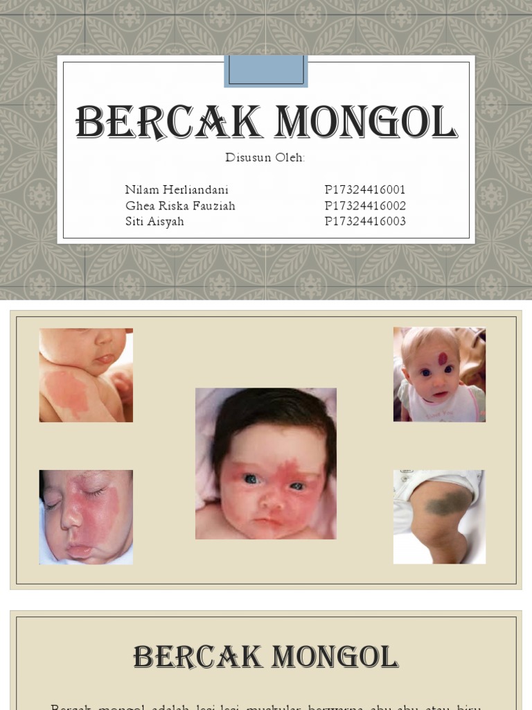 Bercak Mongol | PDF
